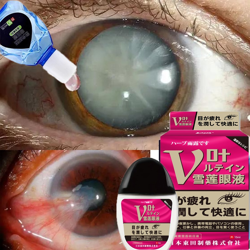 eye drop ubat mata katarak mata ubat 日本眼药 eye drop for red eye dry eyes ...