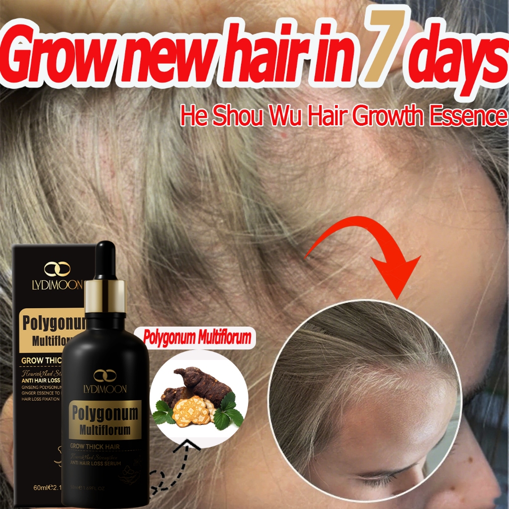 Polygonum Multiflorum Hair Growth Serum 50ml Anti Hair Loss Care Hair ...