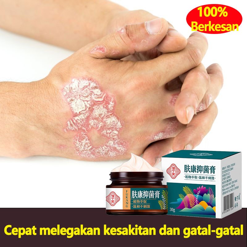 Krim ekzema psoriasis krim antibakteria krim gatal peribadi krim gatal ...