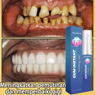 Ubat penguat gigi goyang 4ml, penjagaan gigi, gel pemutih gigi, gel ...