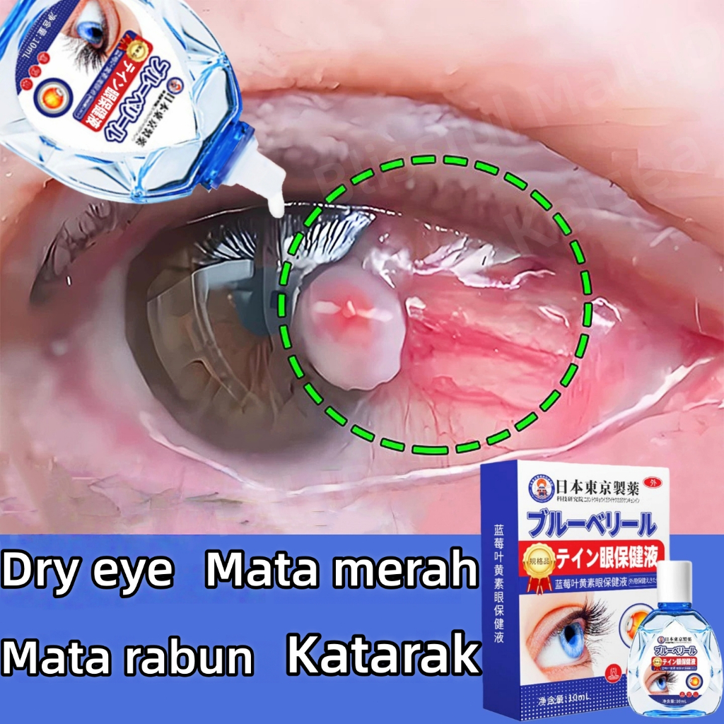 Japan Obat mata katarak Eye drops for dry eye Rawatan Mata rabun Mata ...