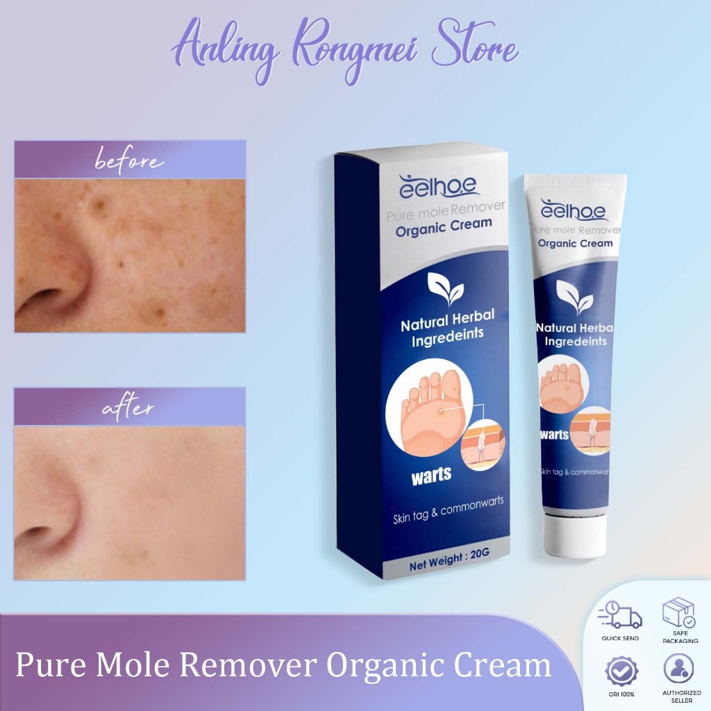Mole Remover Organic Cream 20g Mole Remover Cream Skin Tag Remover ...