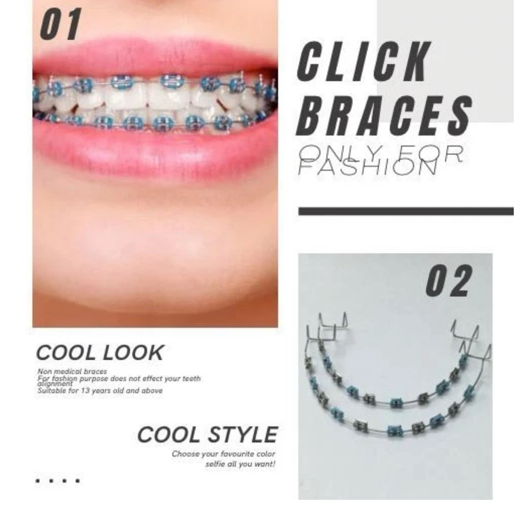 temporary tooth decoration - clip on braces | Shopee Malaysia