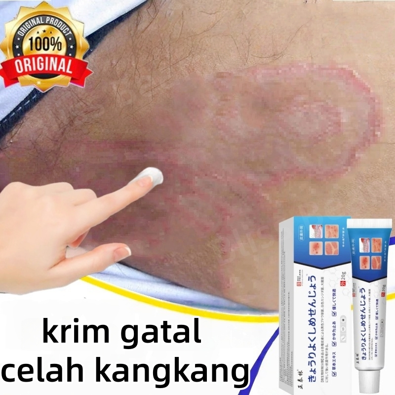 krim gatal celah kangkang ubat gatal kulit ubat kurap Antifungal cream ...