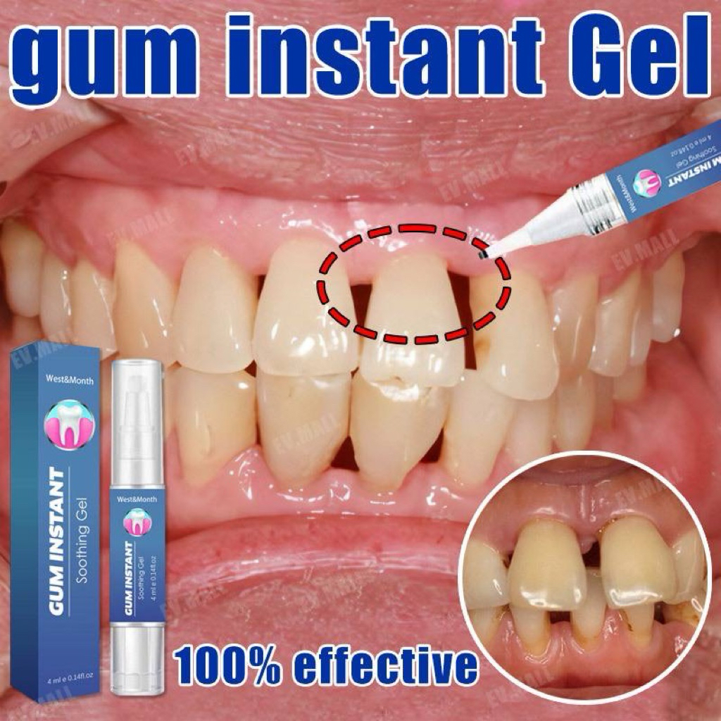GUM INSTANT SOOTHING GEL pelindung gusi dan gigi Rawatan keradangan ...