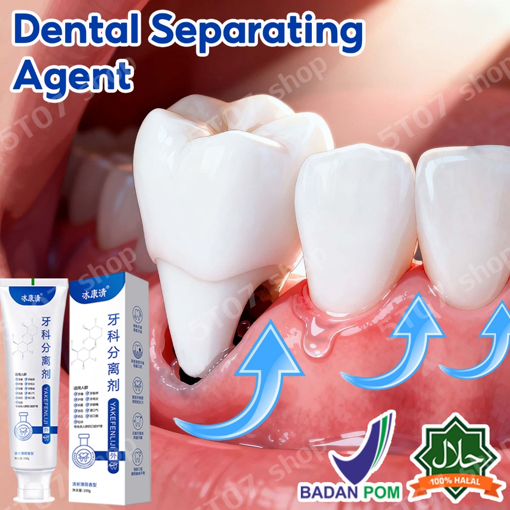 Dental Separating Agent 100g gum repair toothpaste Pasta Gigi Perbaikan ...