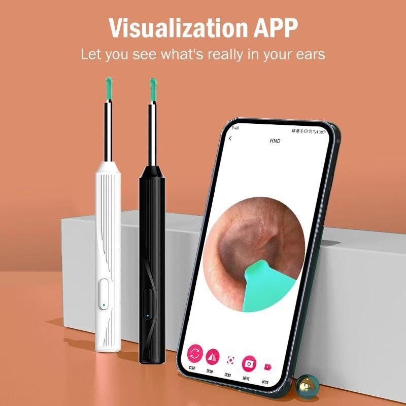 Smart Visual Earpick with Camera – Otoscope Earwax Remover for Baby ...