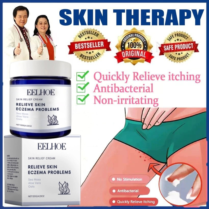 Ubat gatal kulit Psoriasis cream Krim gatal celah kang Antifungal itchy ...