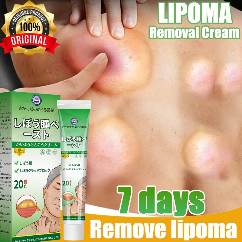 Lipoma Removal Cream Fat Granule Care Cream Fatty Ointmen Lipolysis Fat ...