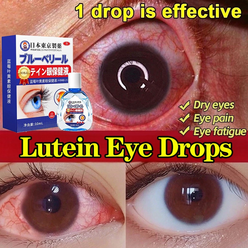 Lutein Eye Drops 10ml叶黄素滴眼液 Blueberry eyedrops,Anti fatigue, anti ...