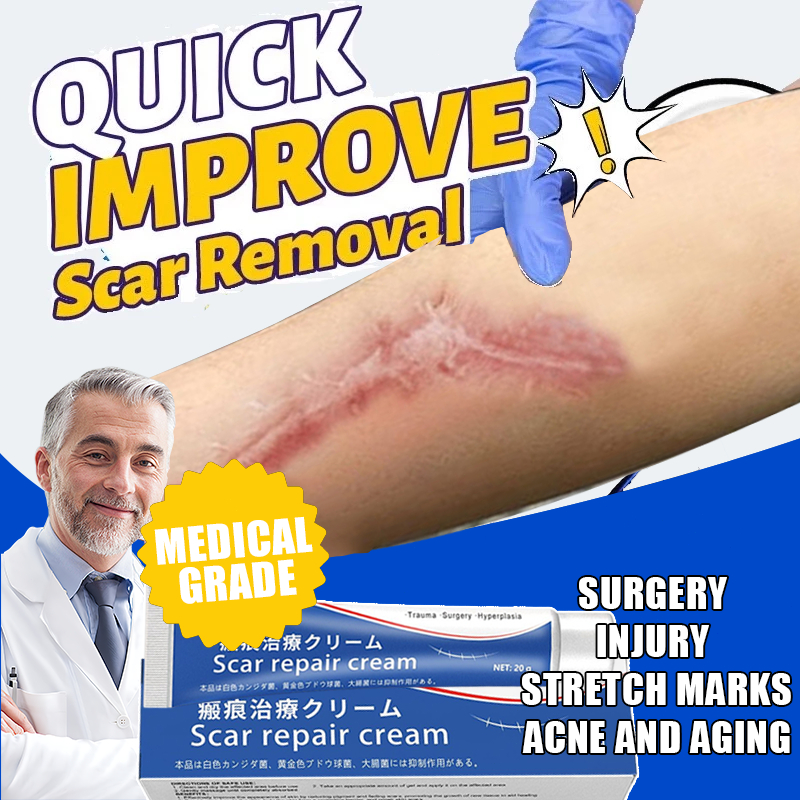 Scar Removal Cream Treatment Remove Stretch Marks Burns Scald Repair ...
