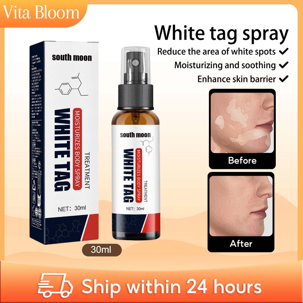 South Moon White Spots Spray 30ml Reduce The Area Of White Spots ...