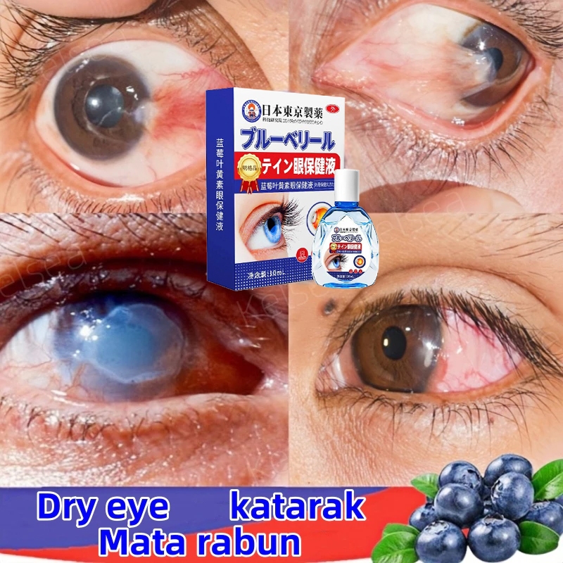 Blueberry Eye Drops Obat mata katarak Eye drops for dry eye rawatan ...