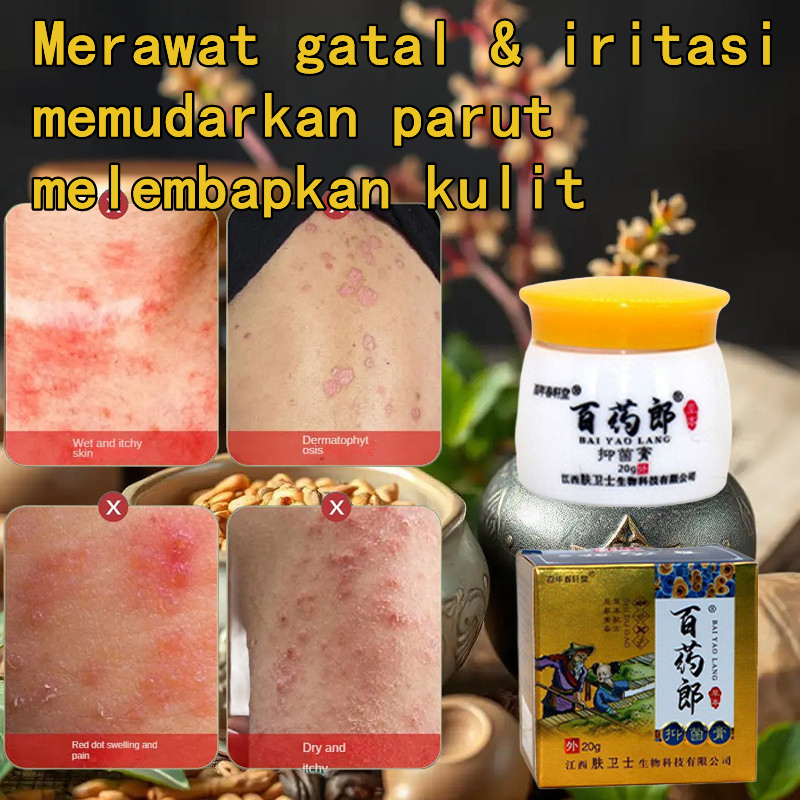 BAI YAO LANG 20g HEALING Cream Treatment of Allergic Skin Itching Eczema Seasonal Allergies and ...