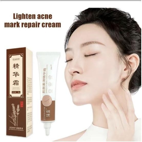 Scar Repair Smoothing Cream Reduce Melanin&Fine Lines Lighten Wrinkles ...