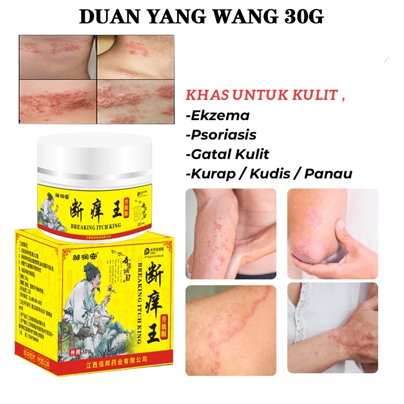 【Buy2Free1&COD】ubat kurap ubat gatal kulit krim gatal kulit herba cina ...