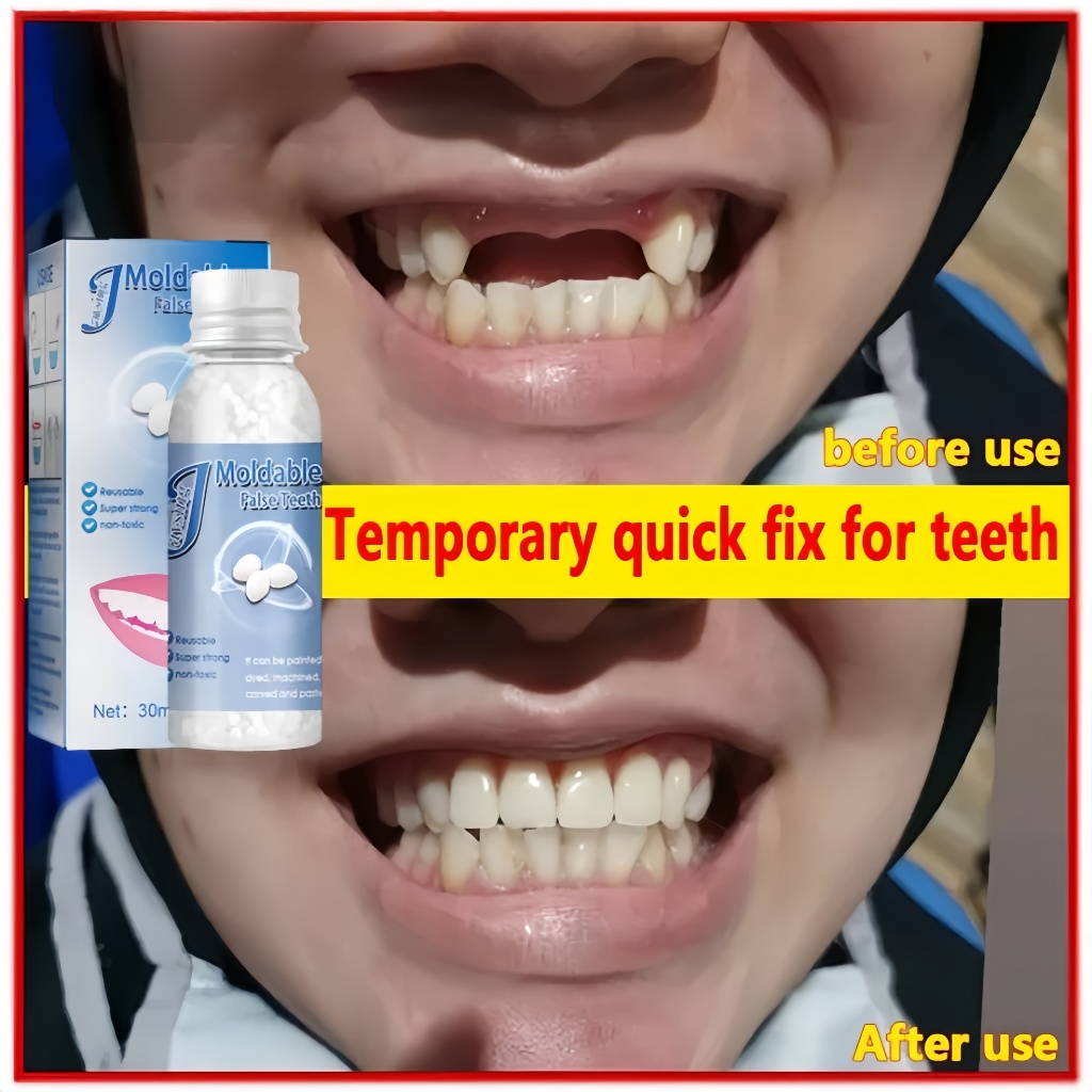 Diy Gigi Palsu Temporary Tooth 30g Repair Kit Teeth And Gaps FalseTeeth ...