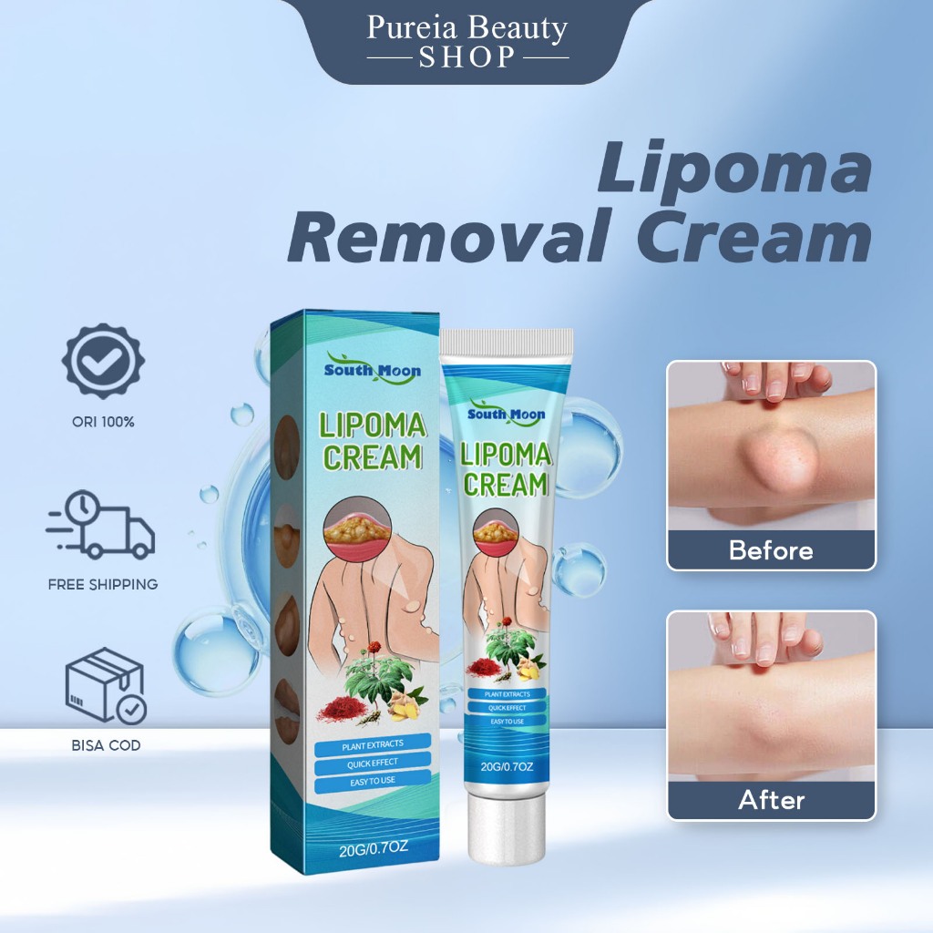 Lipoma Removal Cream original 20g Herbal Formula Removing Multiple ...