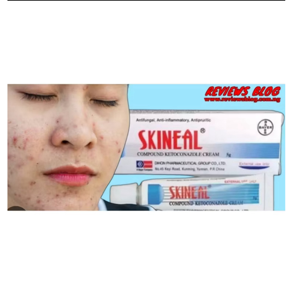 VIXA SKINEAL for face and body 15g/ditunjukkan untuk penggunaan topikal pada rawatan jangkitan ...