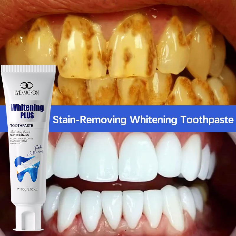 Whitening toothpaste 120g pemutih gigi Remove Smoke-stained& coffee ...