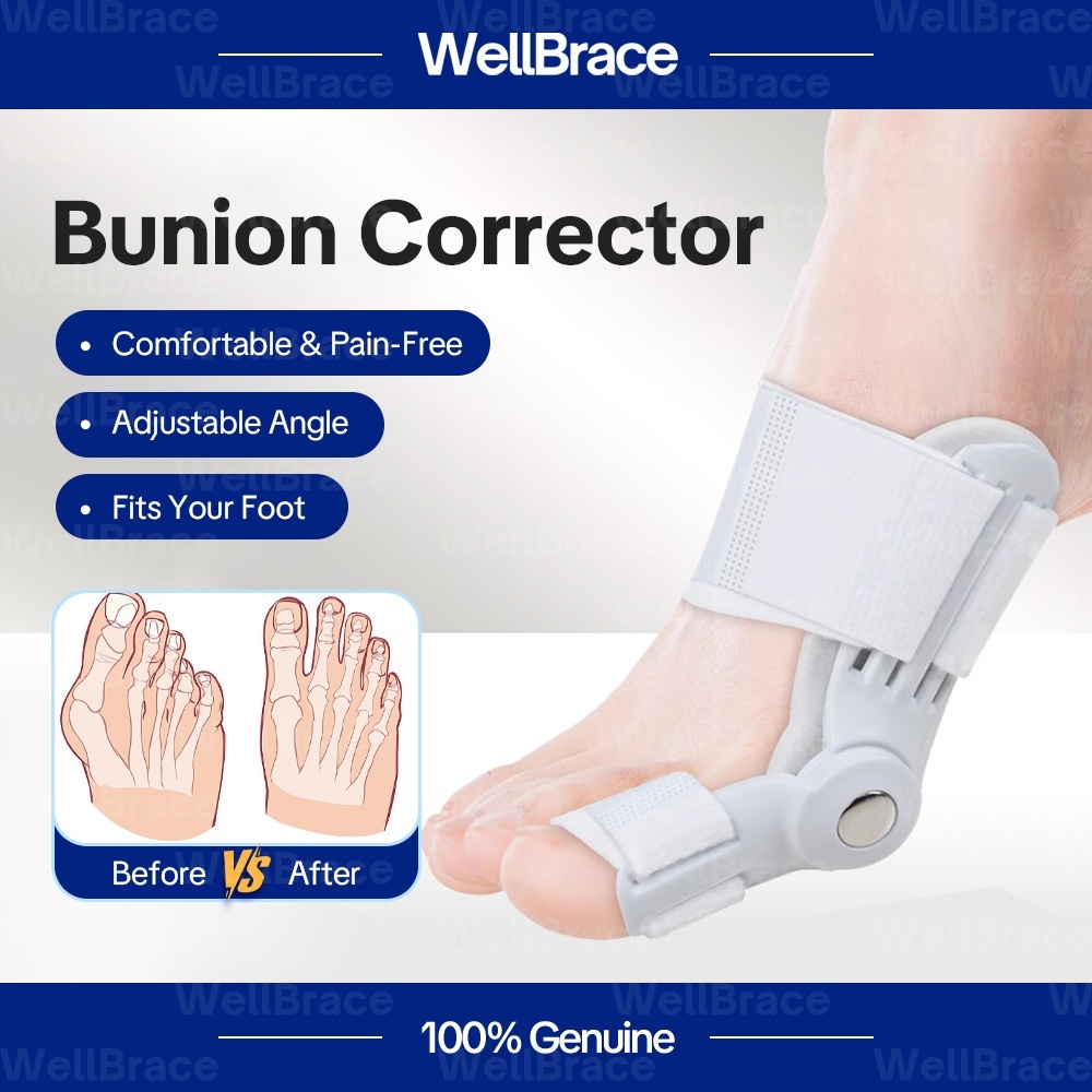 Bunion Corrector,Toe Spreader&Alignment Splint for Hallux Valgus Toe ...