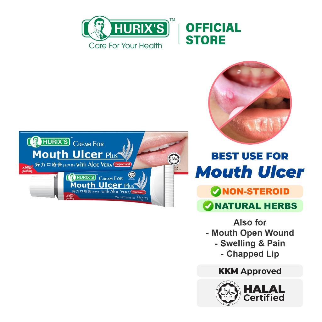 HURIX'S Cream for Mouth Ulcer (with Aloe Vera) Improved - Ulser Mulut ...