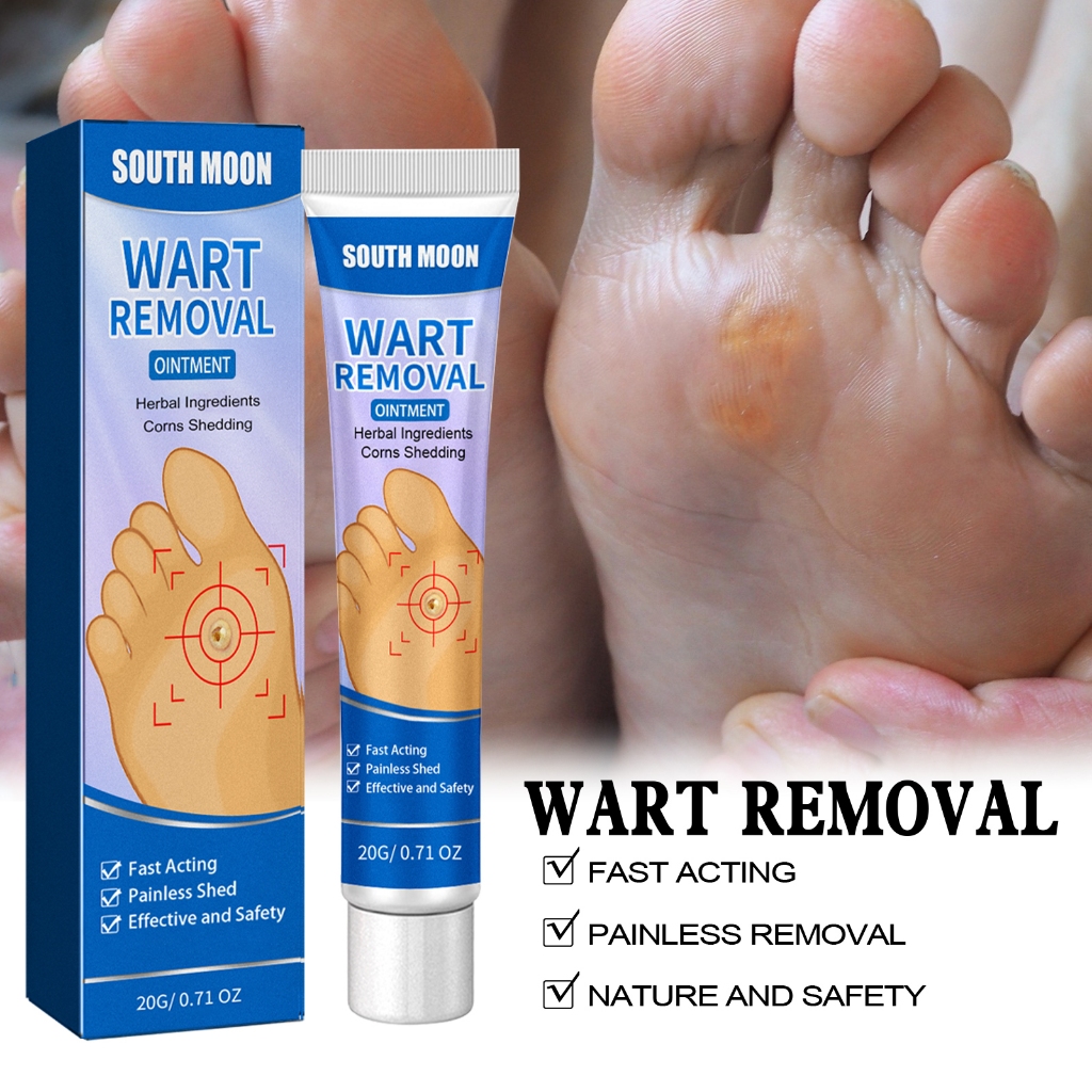 Ubat Ketuat Tapak Kaki Ubat Mata Ikan Penampal Ketuat Wart Remover ...
