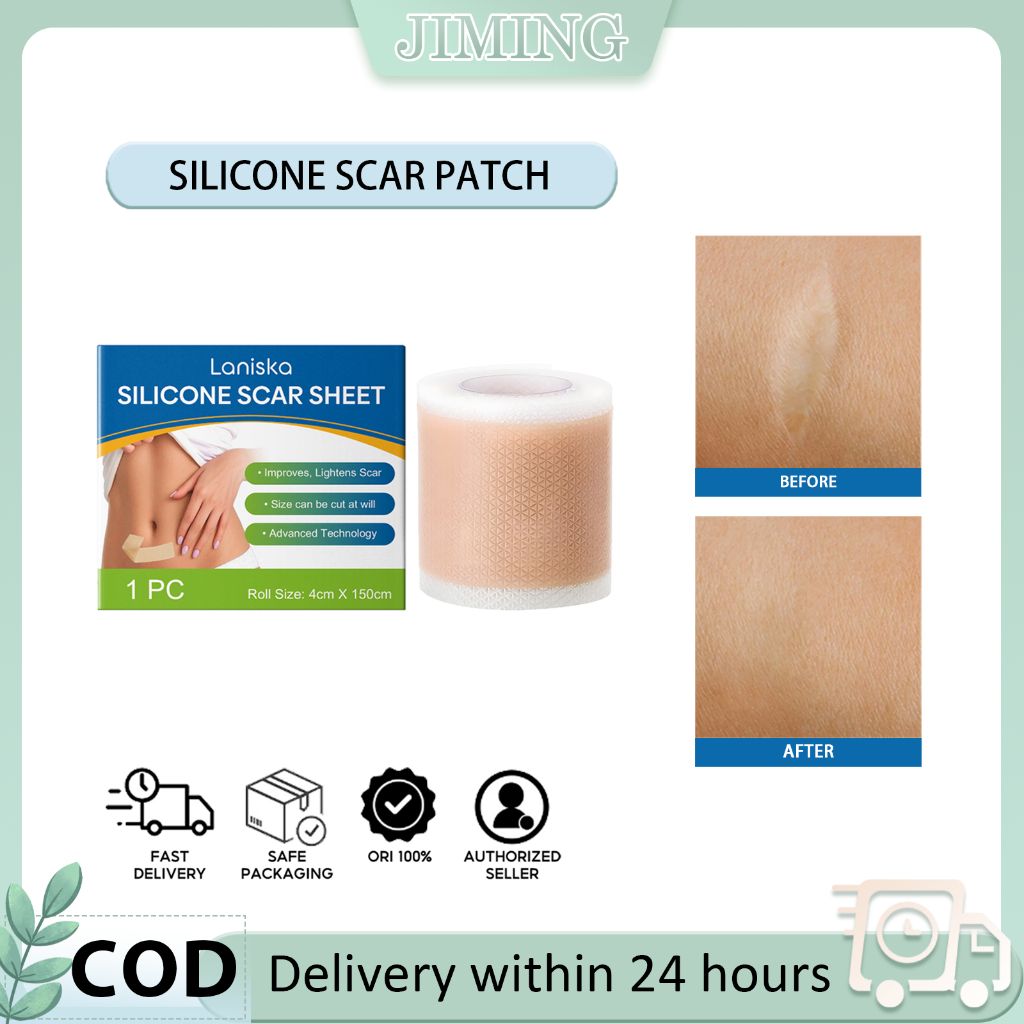 Silicone scar care patch Scar patch Keloid Scar Removal Scar silicone ...