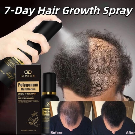 LYDIMOON Hair Growth Spray Hair Tonic Serum 110ml with Polygonum ...