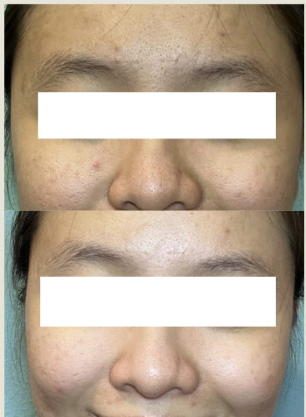 CLEF Ocean Elixir Multi-Algae Hydrating Trial Moisturiser 15g ...