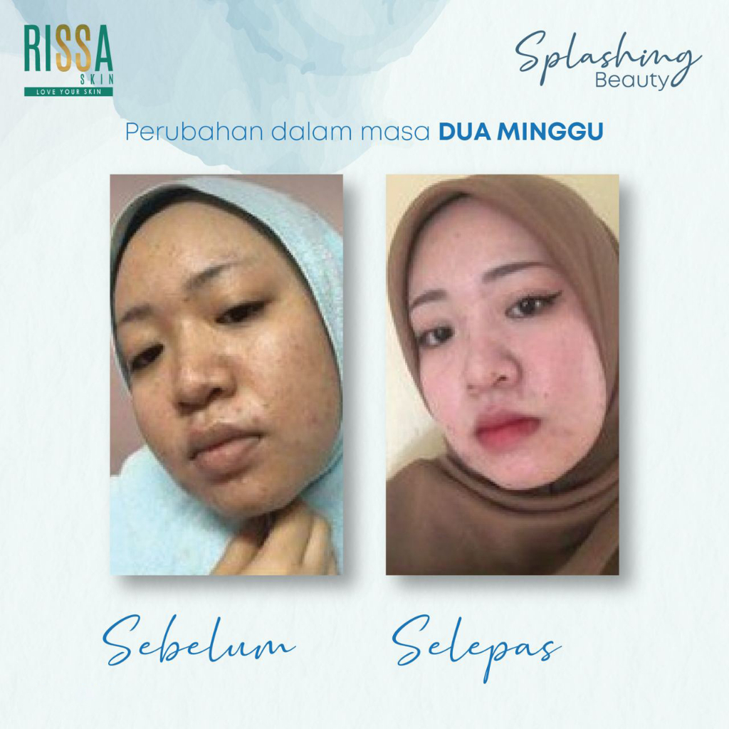 RISSA SKIN Original HQ Skincare 4 in 1 Rissaskin Set Birds Nest ...