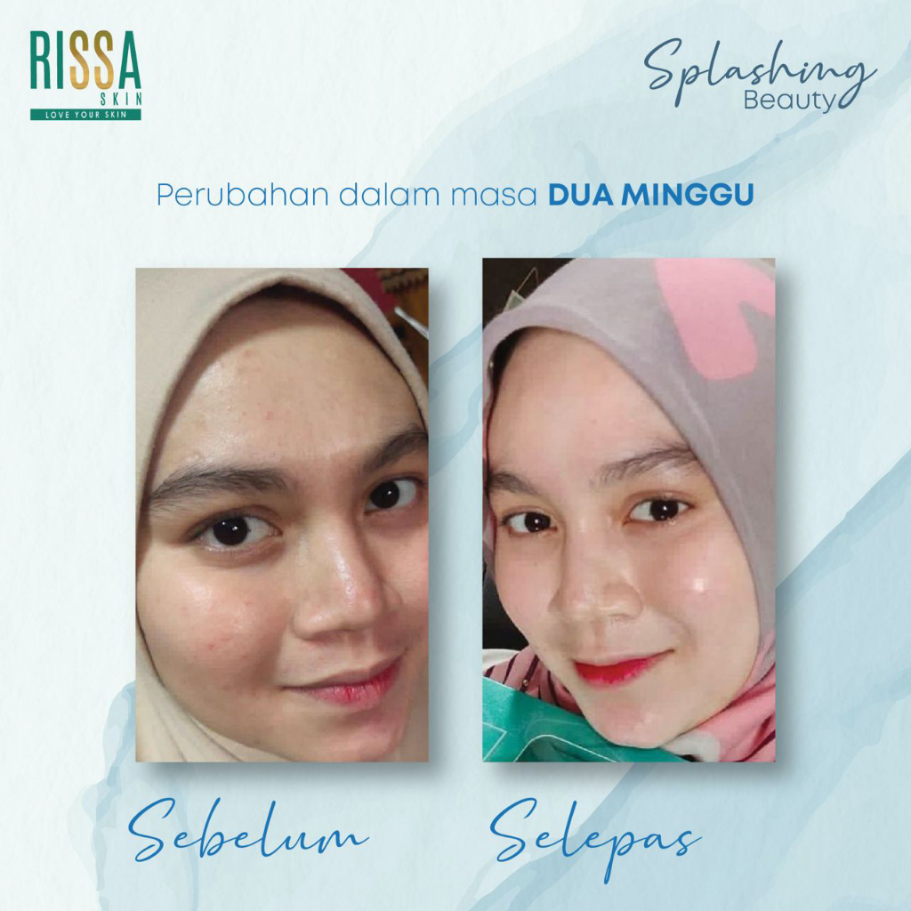 RISSA SKIN Original HQ Skincare 4 in 1 Rissaskin Set Birds Nest ...