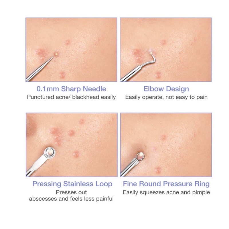 Stainless Steel Pimple Kit Set Besi Picit Jerawat Acne 黑头粉刺针 粉刺夹 ...