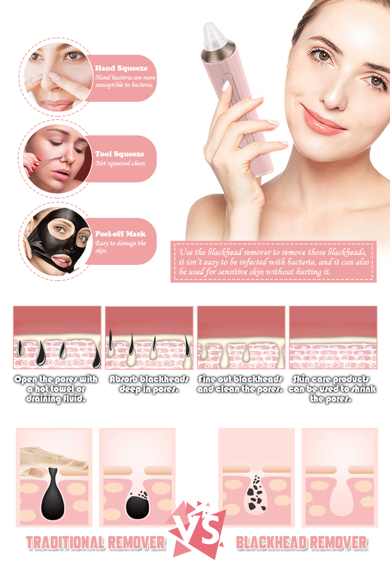 Electric Blackhead Removal With 3 Level Suction 4 Care Heads Pore ...