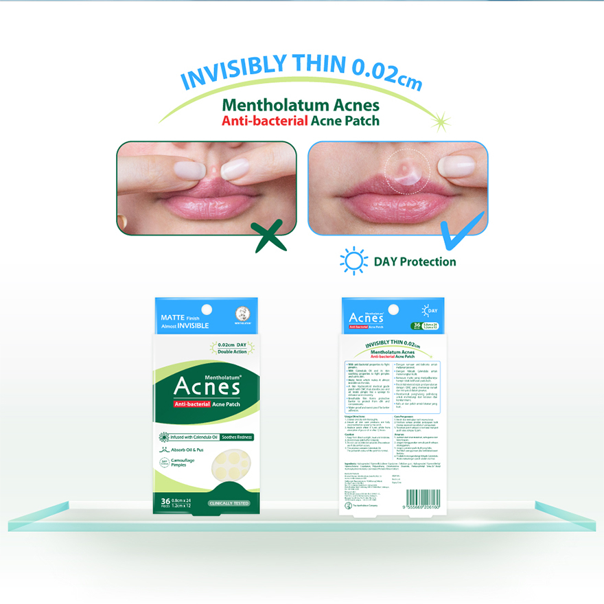 Mentholatum Acnes Anti-Bacterial Calendula Day Patch 36's x 0.02cm ...
