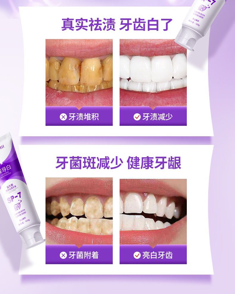 YAYASHI SP-4/SP-7 Probiotic Whitening Toothpaste 益生菌美白牙膏 | Shopee Malaysia