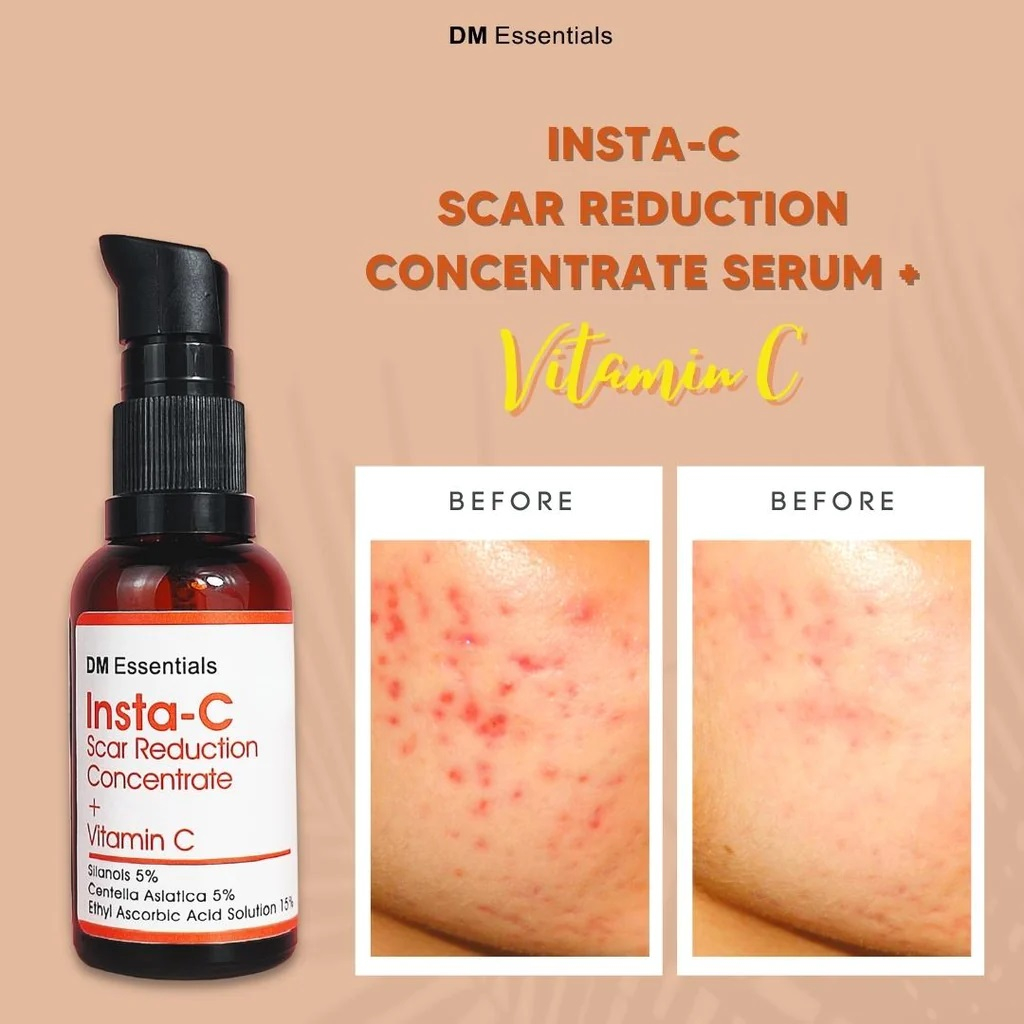 DM Essentials Scar Reduction Concentrate + Vitamin C 30ML | Shopee Malaysia