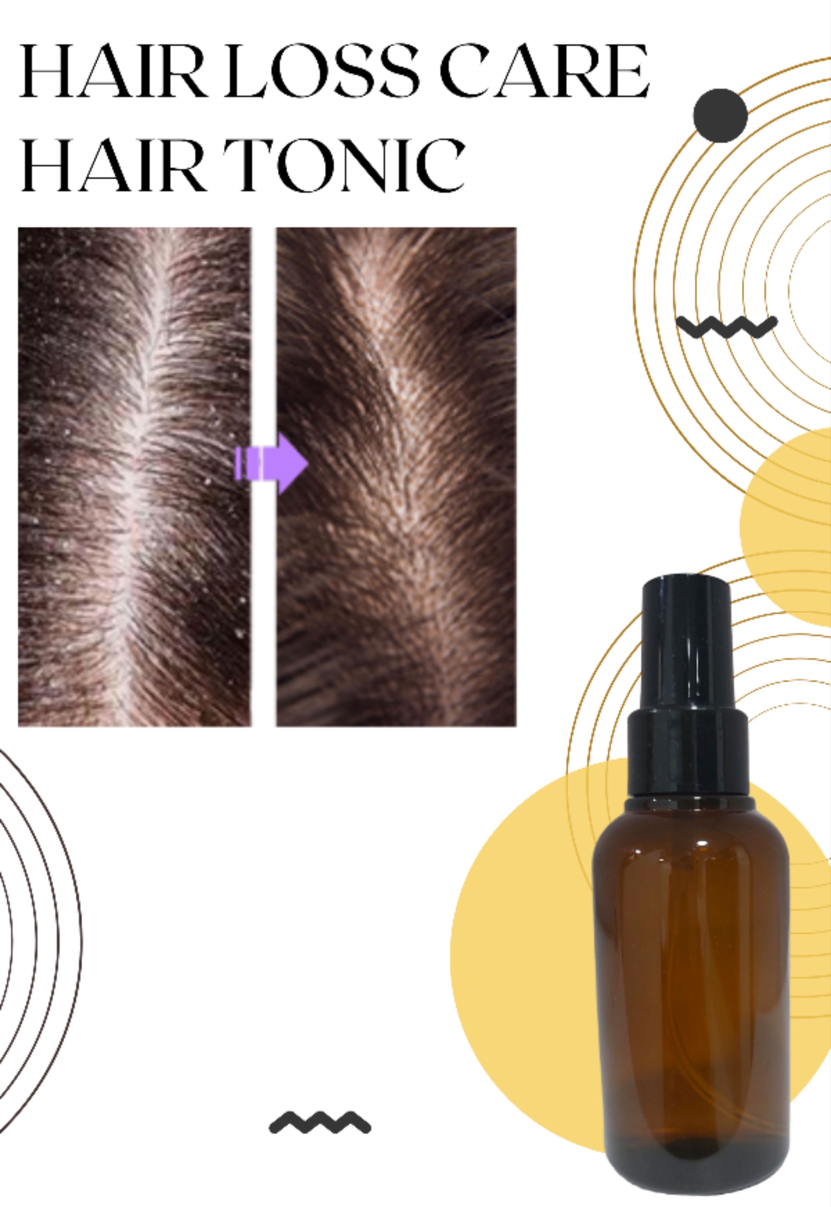 Wholesale Tonic Rambut/Ubat Tumbuh Rambut/Tonic Subur Rambut/Masalah ...