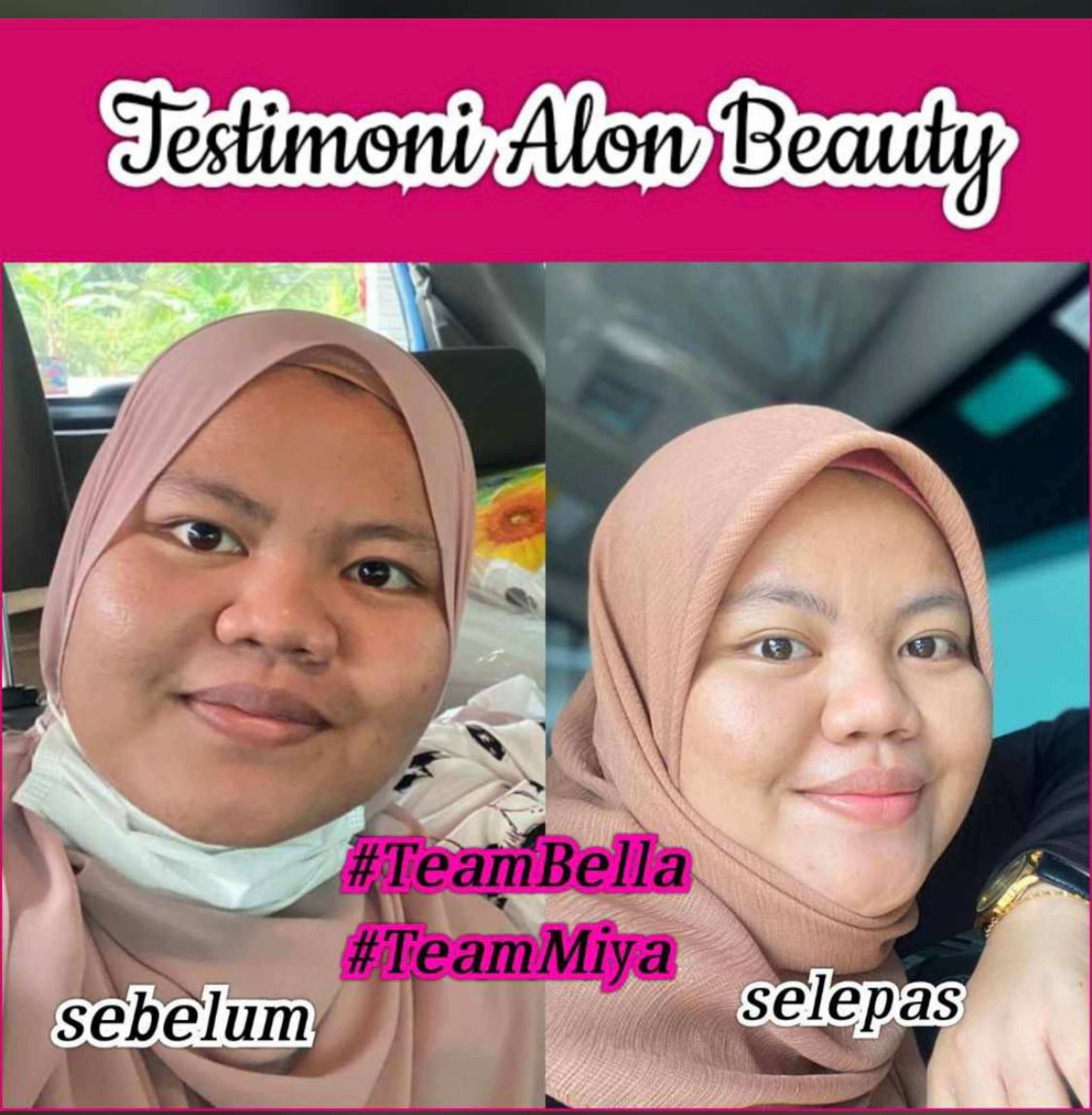 POS TODAY! BEST ALON BEAUTY KRIM PEMUTIH SUPERWHITE ALON BEAUTY >>LULUS KKM
