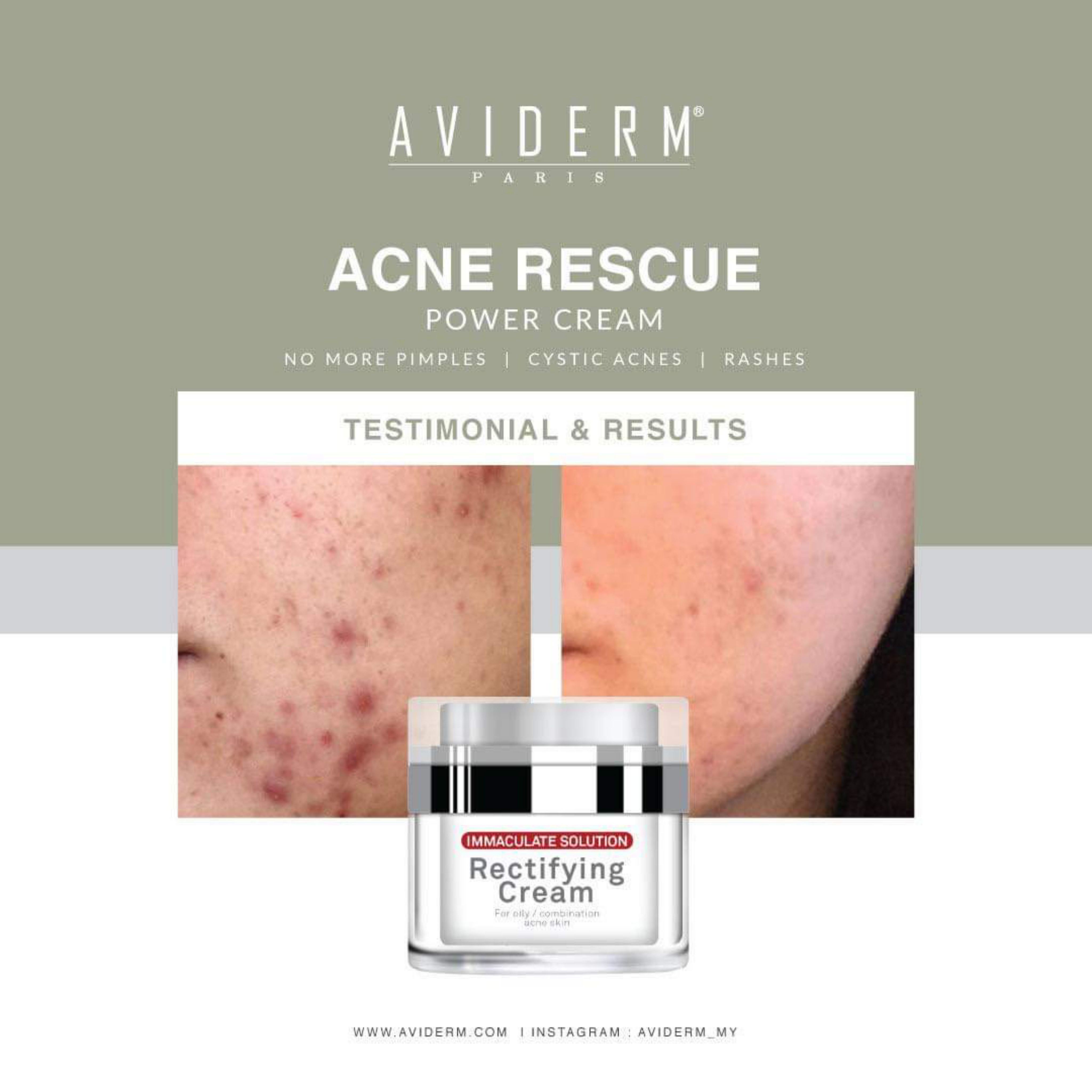 AVIDERM Rectifying Cream 净化| 抗菌| 抗炎| 控油| 愈合| 祛痘霜 (15g) [Exp 2028 ...