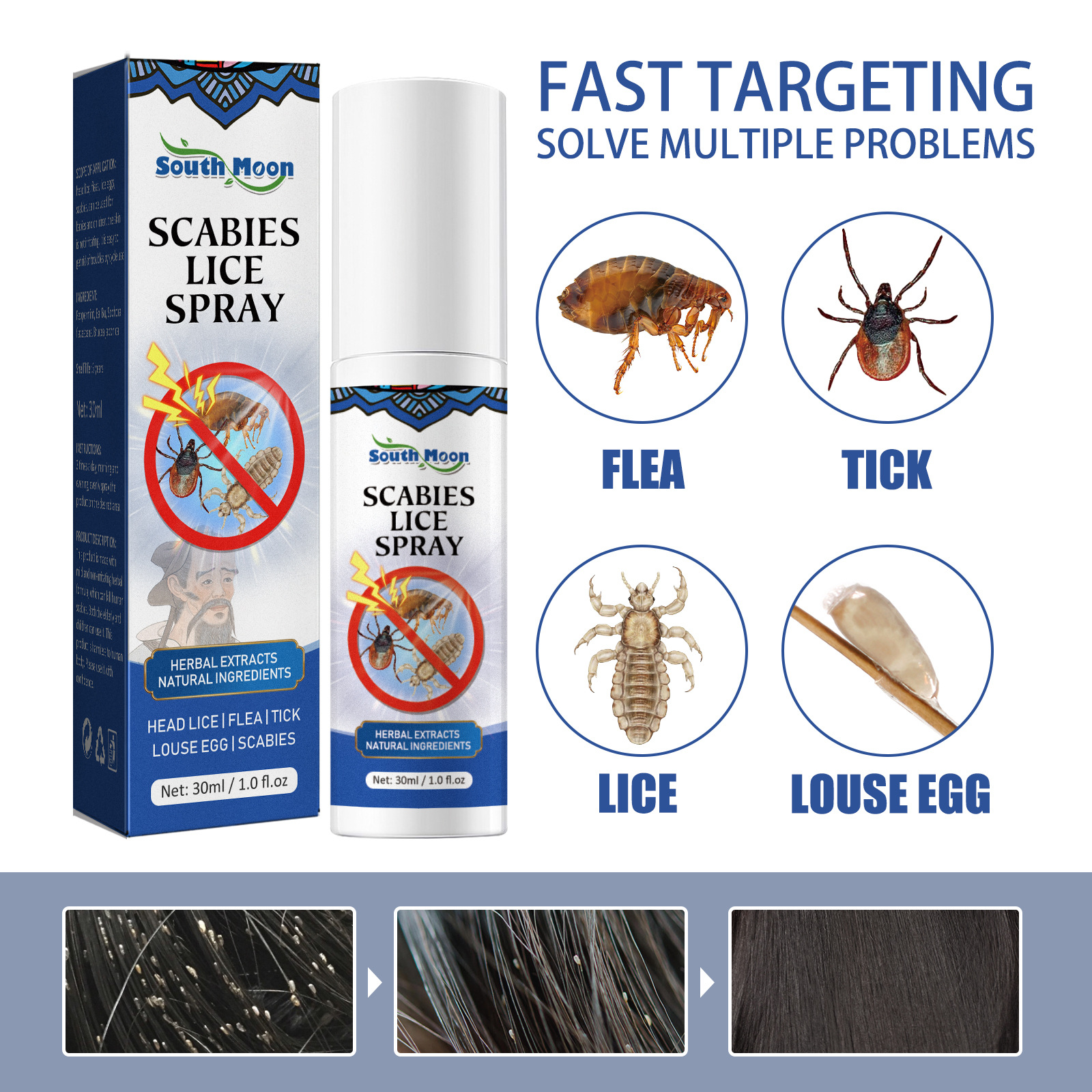 Spray Ubat Kutu Kepala Sangat Berkesan / Head Lice Spray Organik / Ubat ...