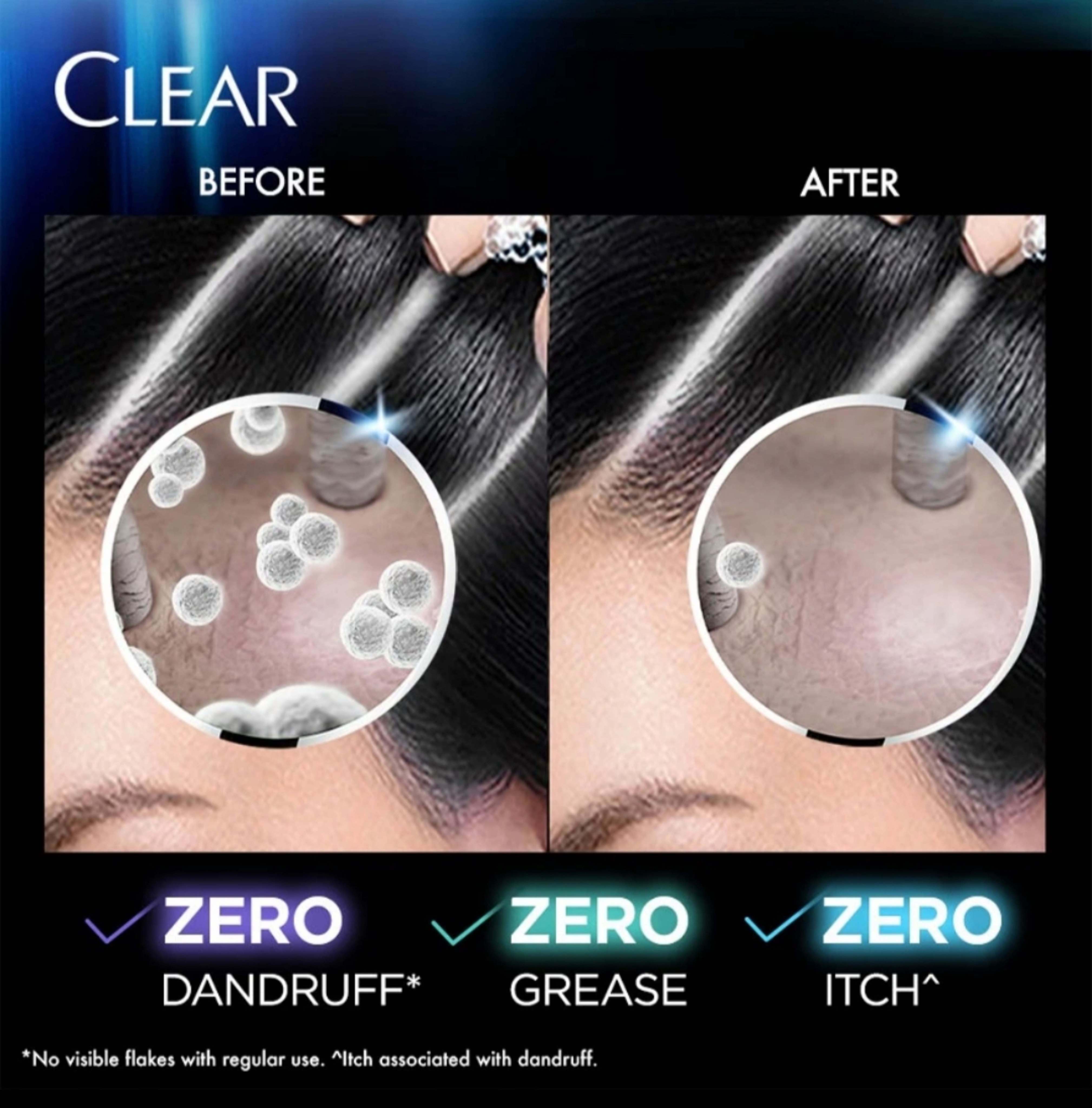 Clear Hair Shampoo Sakura Fresh | Anti Hair Fall Dandruff | Syampu ...