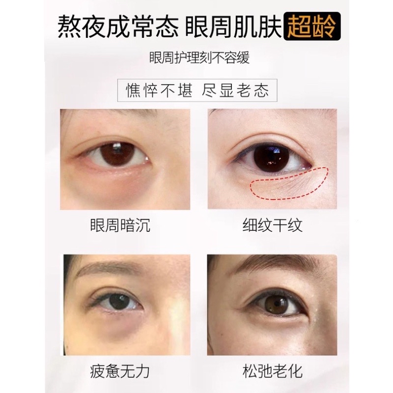 SKIK eyebag skik eye firming roller original SKIK Eye Firming Anti ...