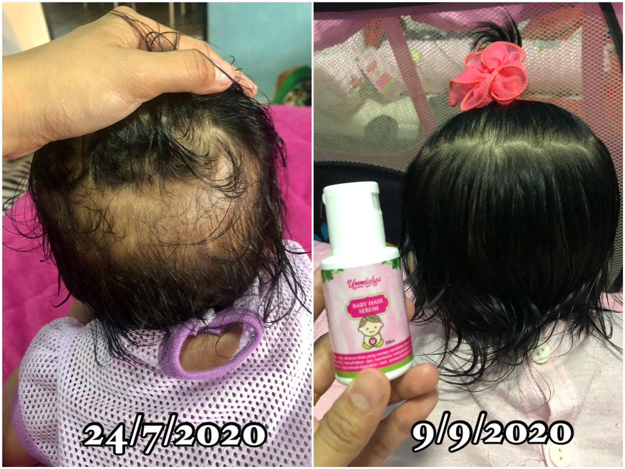 UMMIALYA BABY HAIR SERUM BAYI Minyak Rambut Bayi dan Kanak-kanak ...