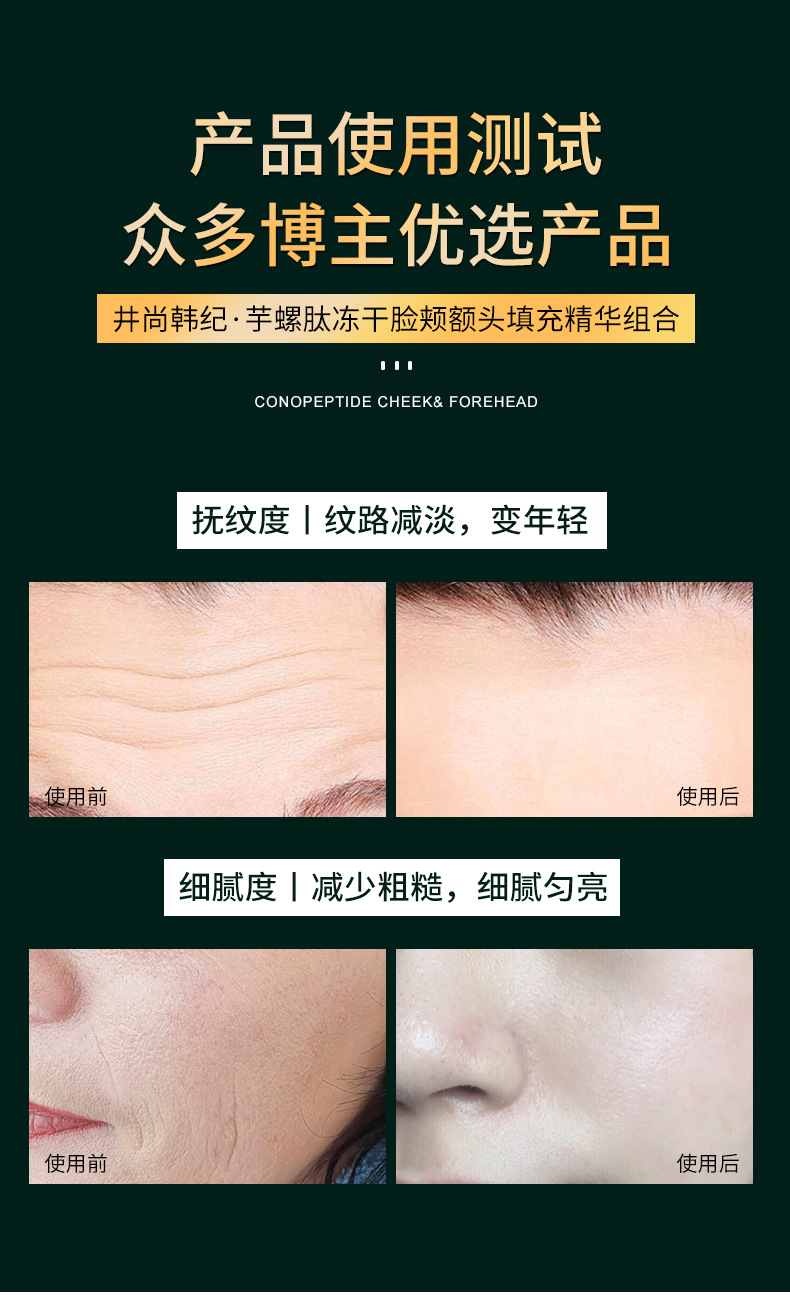 Jinshane Hankey Cono Peptide Cheek & Forehead Filling Serum Combo ...
