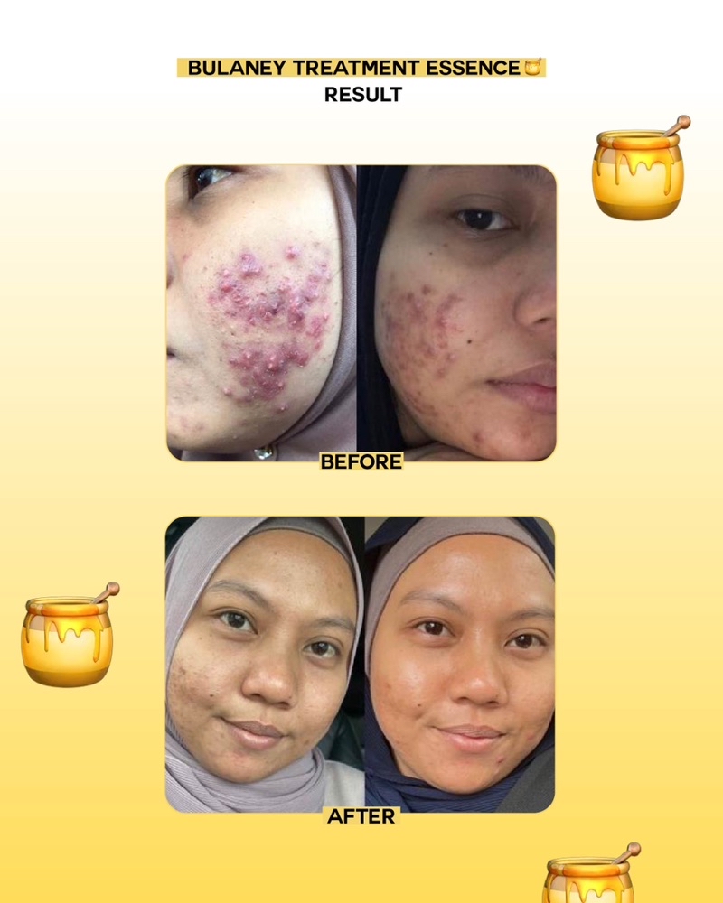 TATAGALTIER FULL SET/ TATAGALTIER ESSENCE / TATAGALTIER CLEANSER ...