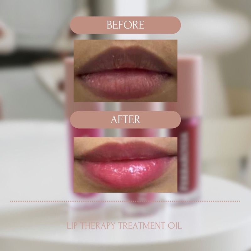 FERRAROSSA LIP OIL TREATMENT & THERAPY (3 COLOURS & FLAVOUR) | Shopee ...