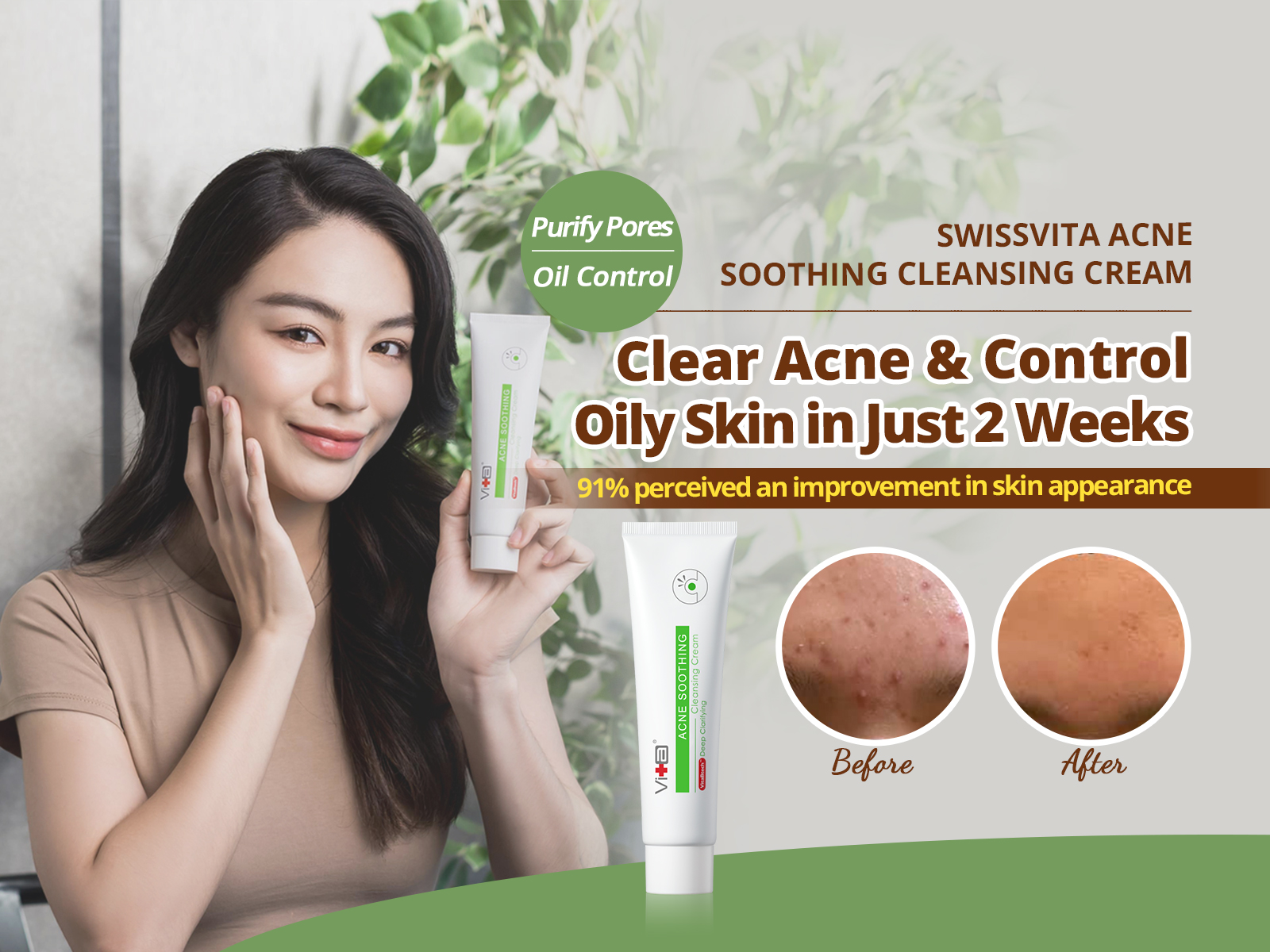 SWISSVITA Acne Soothing Cleanser /facial cleanser/pencuci muka jerawat ...