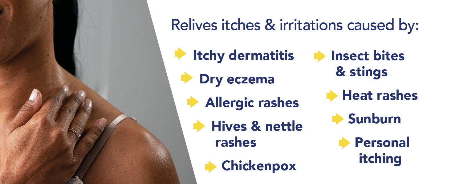 Eurax Itch Relief Cream 30g/100g, Rapid Itch Relief, Lasts Up To 8h for ...