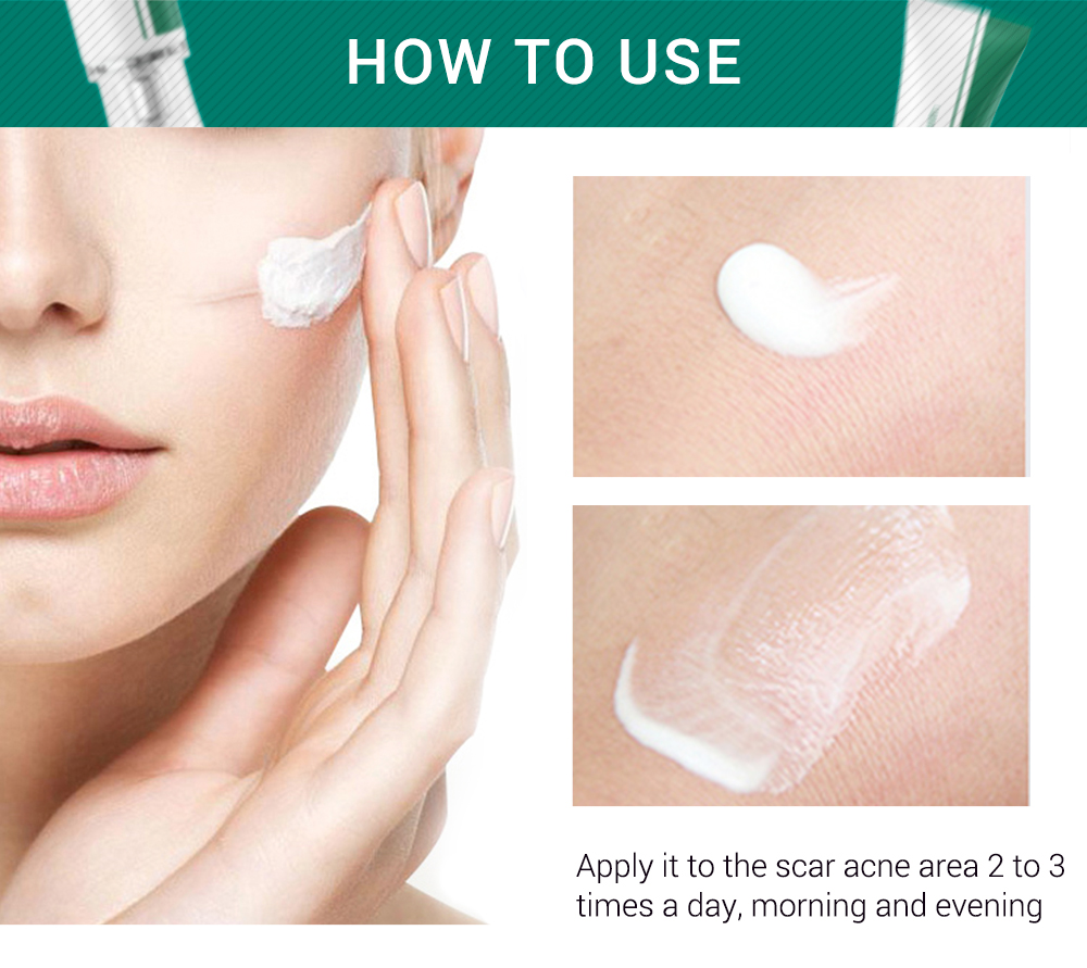 BREYLEE Acne Scar Remover Gel Lighten Stretch Marks Repairing Cream Dark Spot Acne Treatment ...